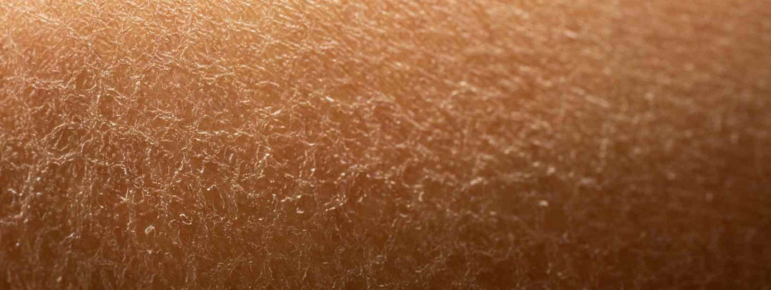 Expert Tips on How to Remove Dead Skin from Your Legs