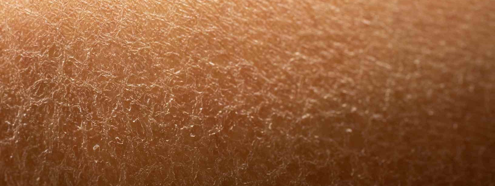 Expert Tips on How to Remove Dead Skin from Your Legs
