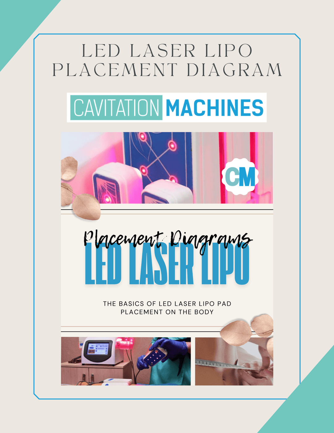 LED Laser Lipo Placement Diagrams