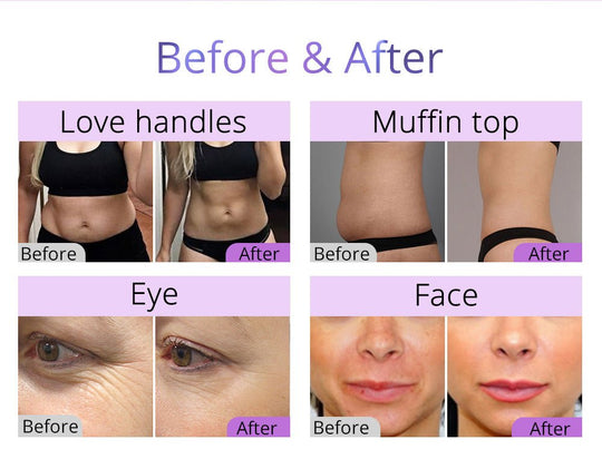 Shape Tactics 5-in-1 80K Cavitation Vacuum Therapy System