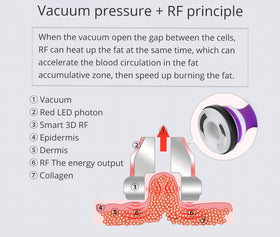 6-in-1 Cavitation LED Laser Lipo & RF Body Sculpting System